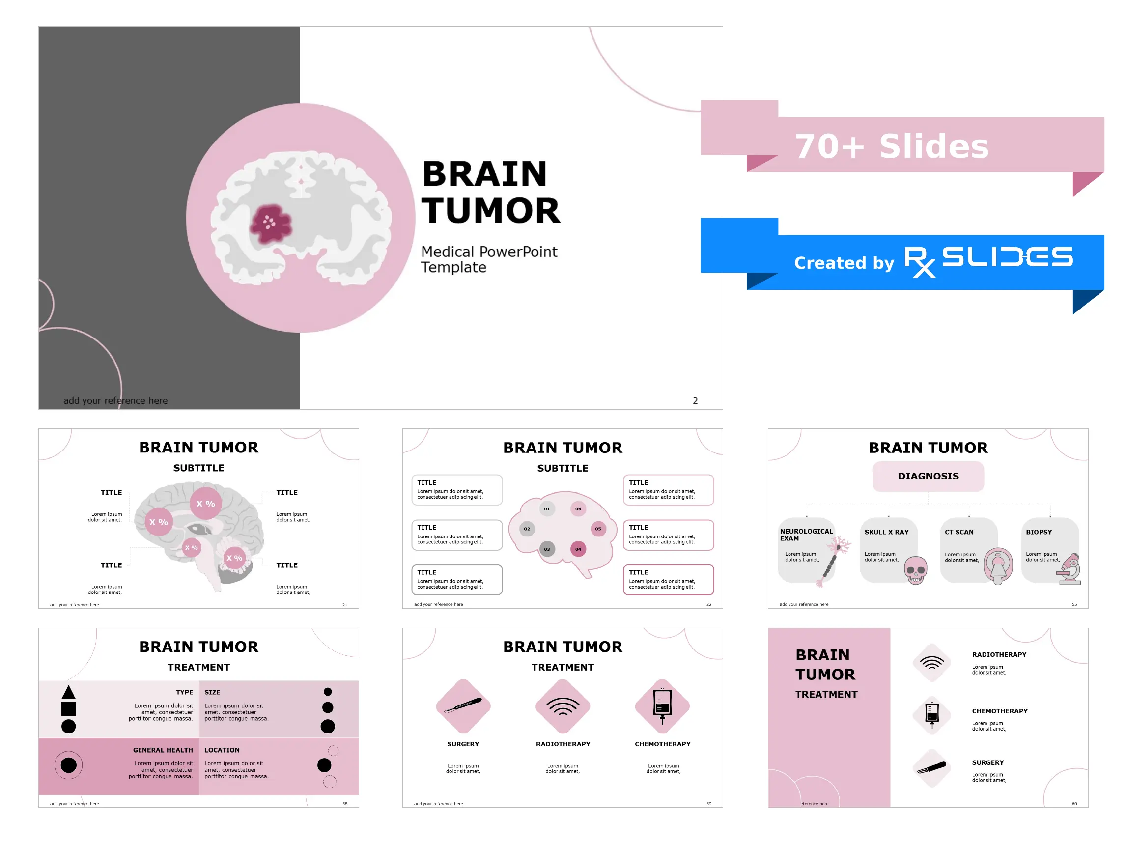 Download Brain Tumor PowerPoint Template| RxSlides